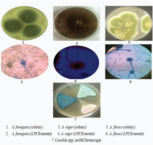 Aspergillus Fumigatus Morphology