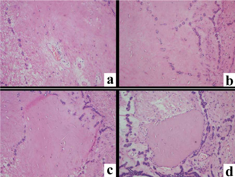 It is hoped that the present and other reports of adenoid odontogenic ...