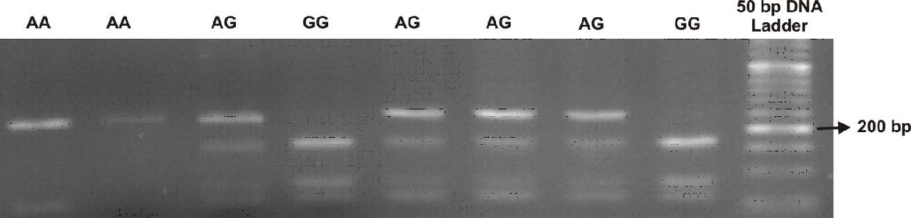 Bioinformatic Analysis