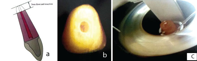 Showing sample cavity preparation in three groups depending on depth of ...