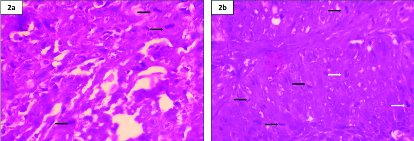 Photomicrograph of anti-PHH3 stain- a) OED and b) OSCC highlighting MF ...