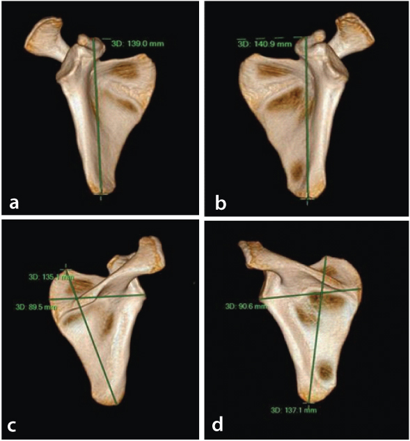 What Is The Difference Between The Right And Left Scapula