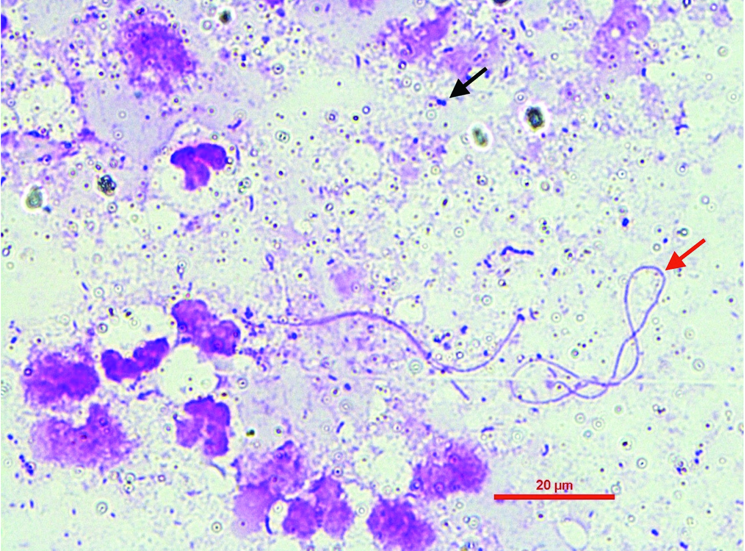 Gram Positive Rods In Clusters