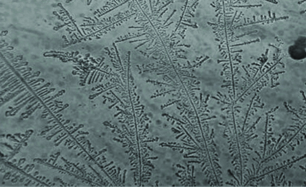 However, in Group B (Non DED) all had normal ferning patterns. A total ...