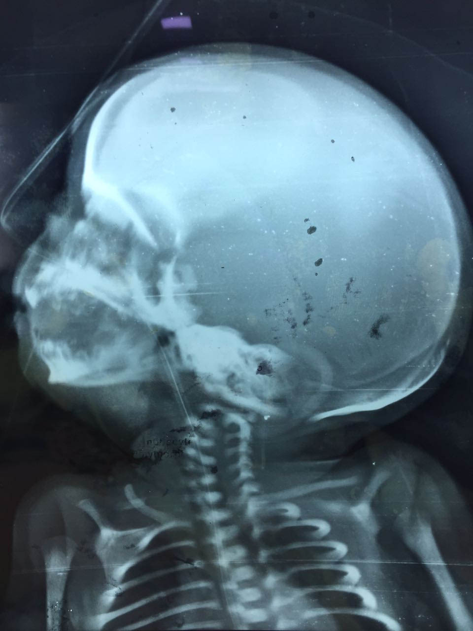 Acrania. Обсуждение на LiveInternet - Российский Сервис Онлайн-Дневников