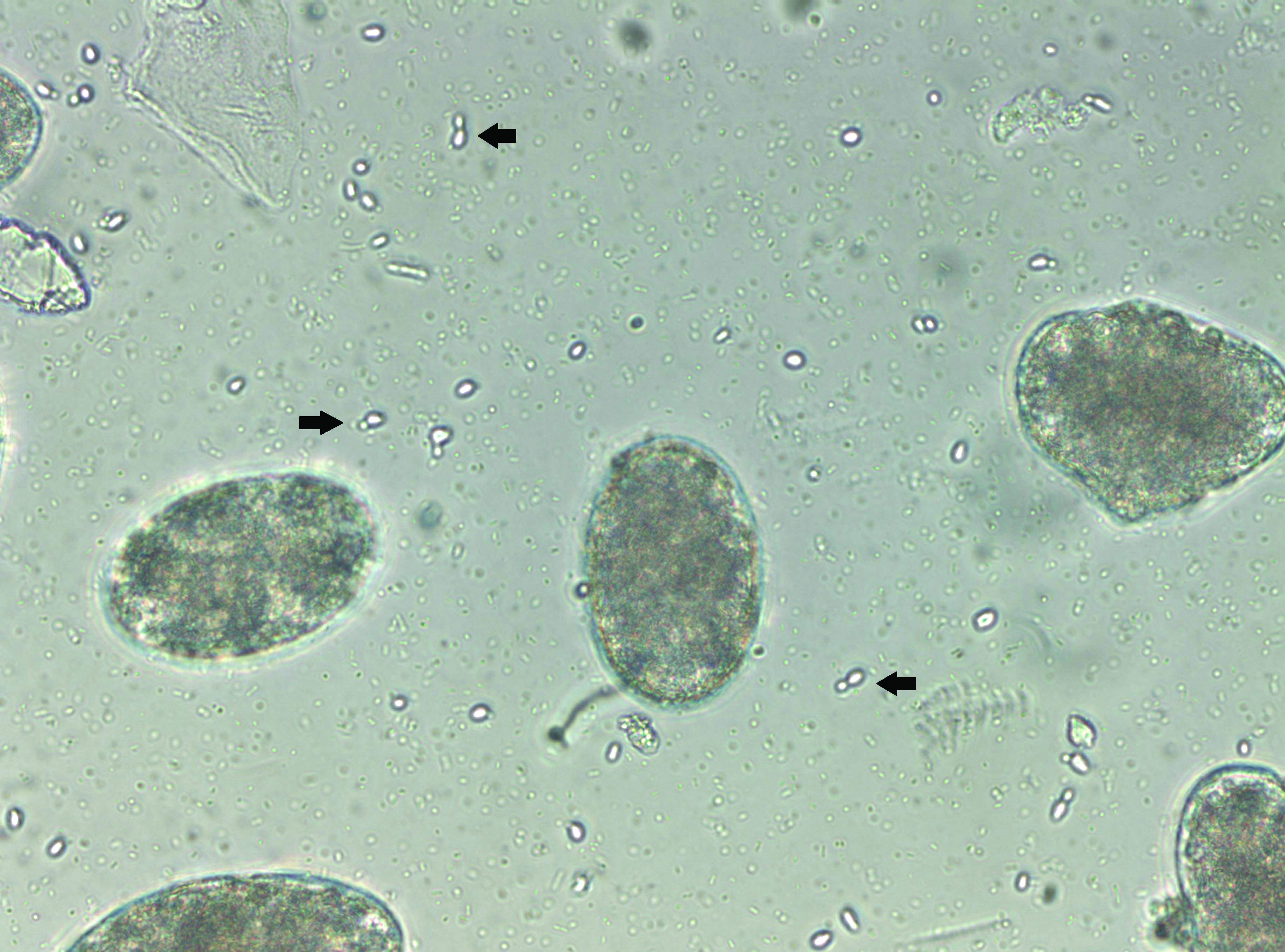 Roundworm Eggs Under Microscope