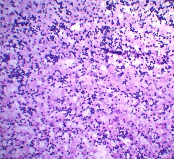 Polymorphs White Blood Cells