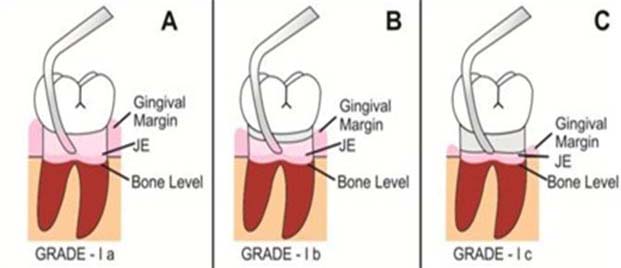 [Table/Fig-2]: