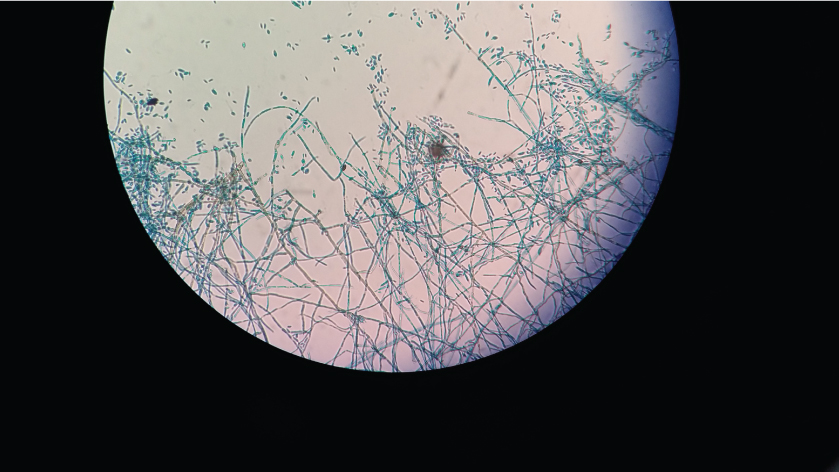 LPCB mount of slide culture- Cladophialophora sp.-Conidia are formed in ...