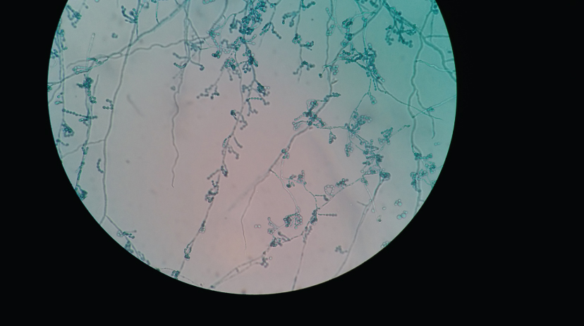 LPCB mount of slide culture- Cladophialophora sp.-Conidia are formed in ...