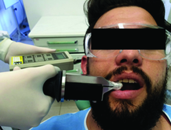 Bite force exam using a gnathodynamometer (digital dynamometer, IDDK ...
