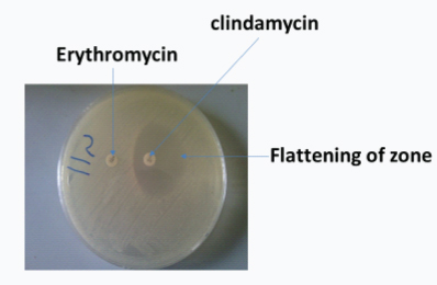 Inducible Clindamycin Resistance test: An inducible clindamycin ...