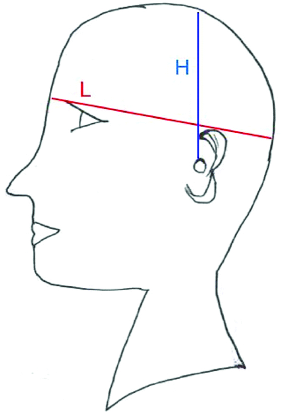 Schematic diagram showing measurement of breadth (B) of the cranium.