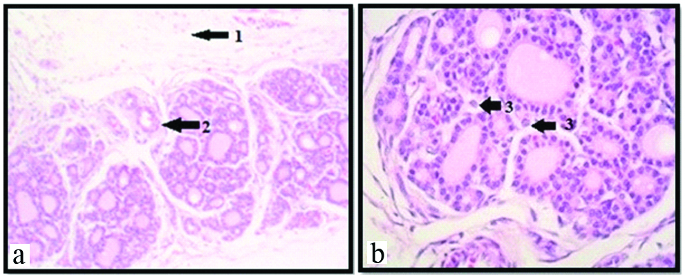 Thyroid Gland Slide Labeled Parafollicular Cells