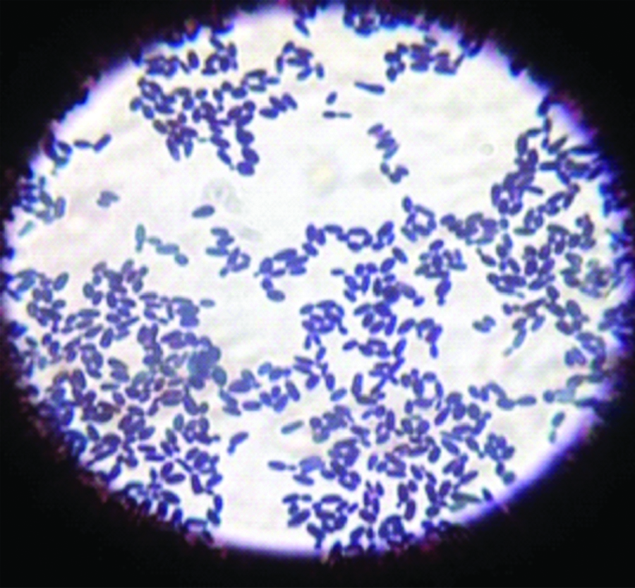 Budding Yeast Gram Stain Round Yeast Gram Positive Cryptococcus