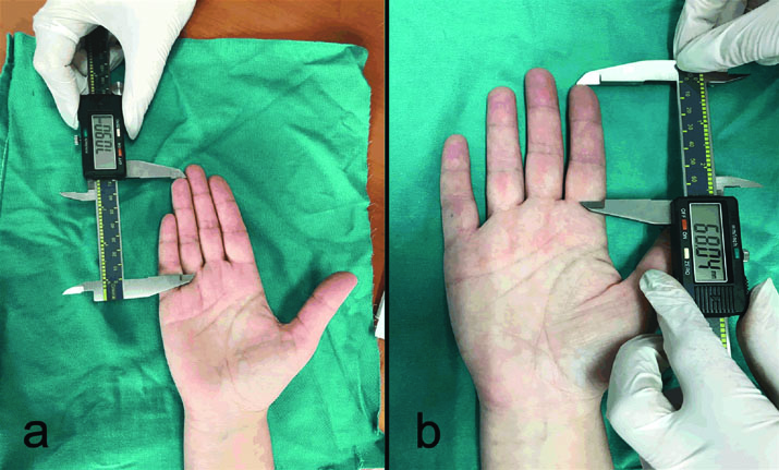 The measurement of ring (a) and index finger (b) lengths.