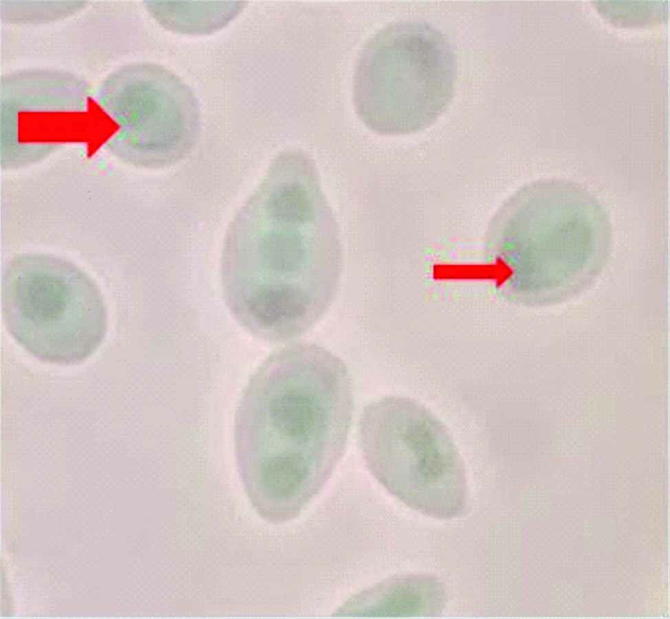Demonstration of ascospores-shows two asci inside ascospores, arrow ...