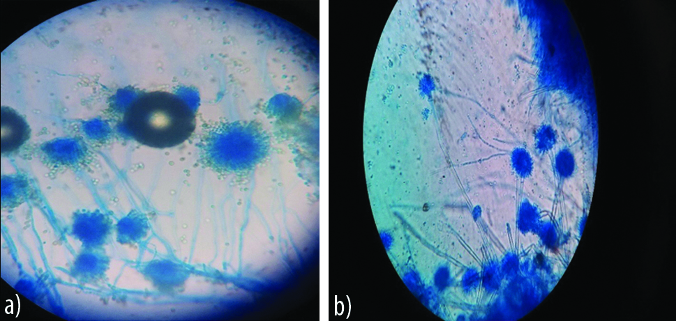 Aspergillus Niger Ear