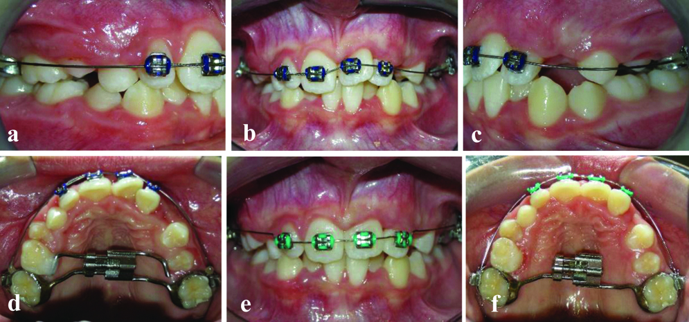 Progress. HYRAX stabilised for 26 months.