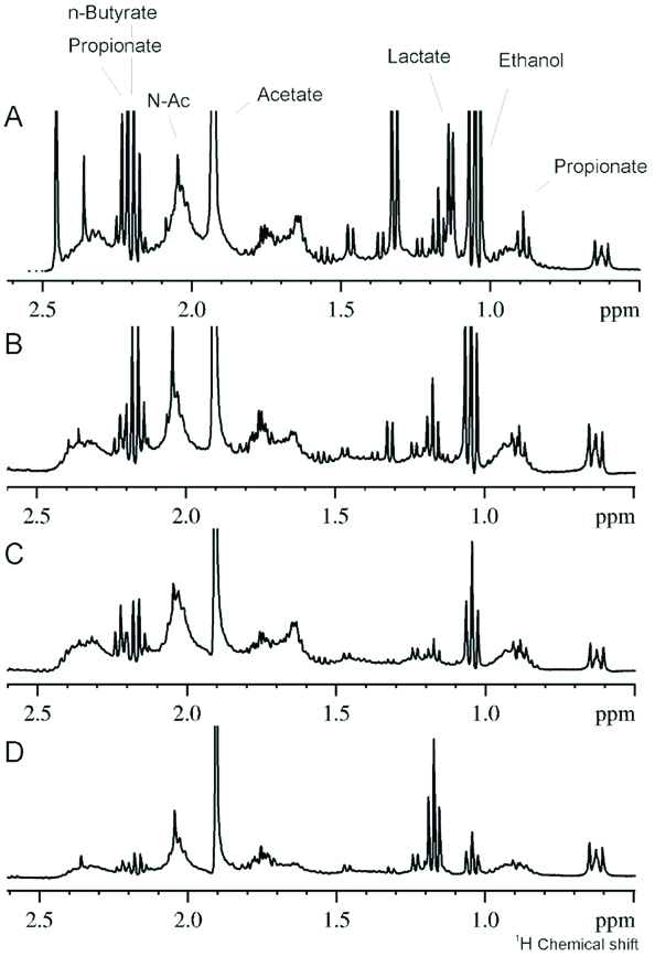 Illustrates the 1 H-NMR breastfeeding milk from three mothers ...