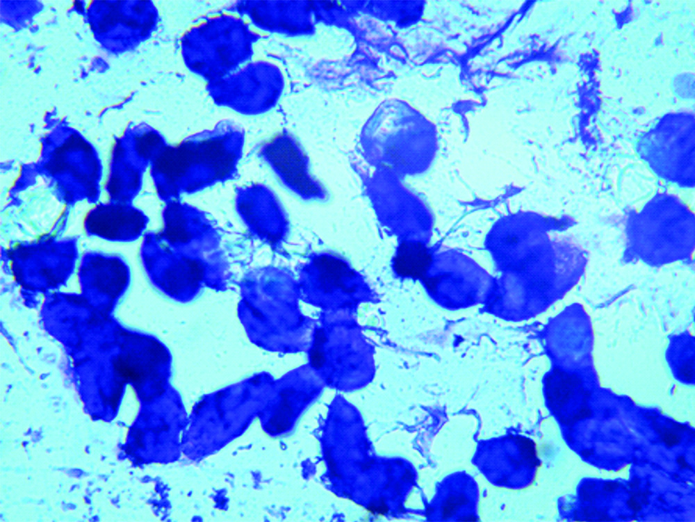 The lesions were treated by electro-desiccation. Local application of 2 ...