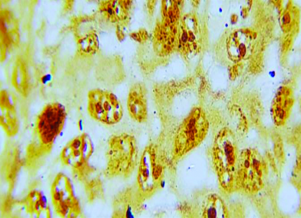 Legionella Silver Stain