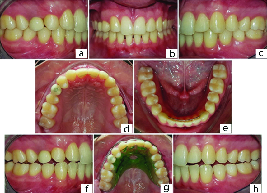 Canine Occlusion Classification