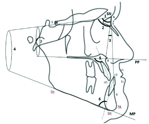 Cephalometric linear measurements: (1) NPerp-A (mm); (2) NPerp-Pg (mm ...