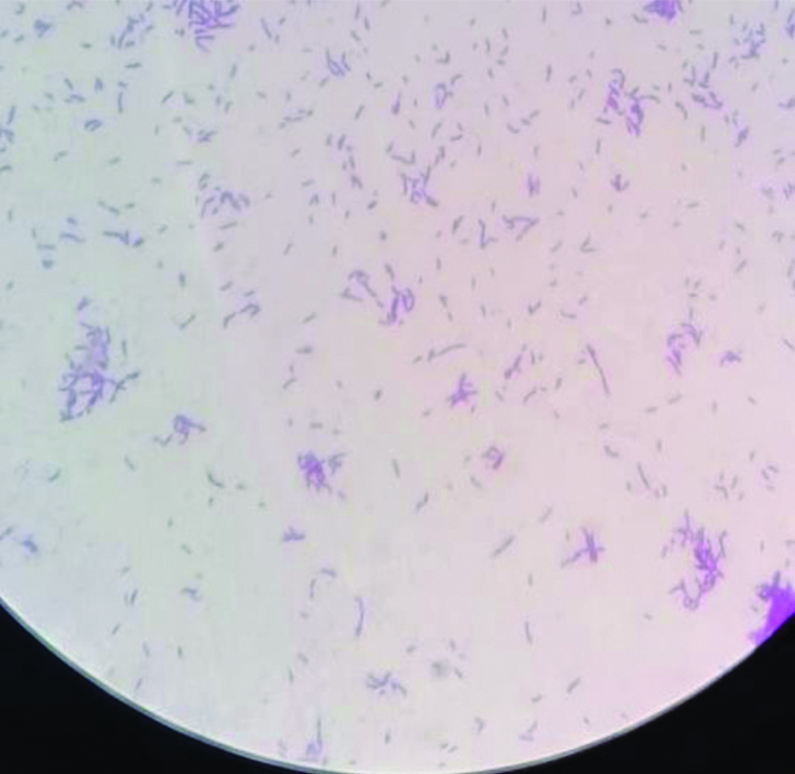 Actinomyces Pyogenes