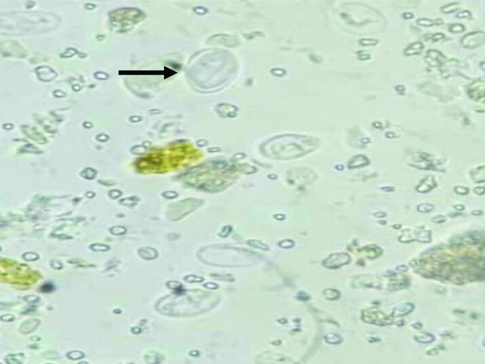 Giardia In Human Poop Giardia Stool Sample Stock Photos and Pictures ...