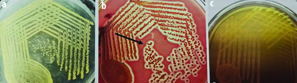 Mucoid colonies of Streptococcus pneumoniae on 5% sheep blood agar.