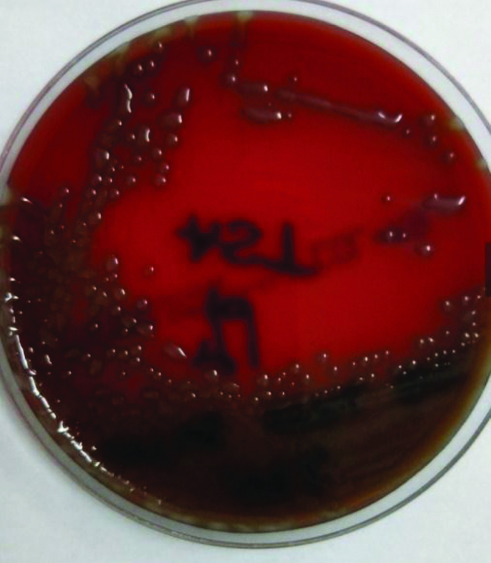 Mucoid colonies of Streptococcus pneumoniae on 5% sheep blood agar.