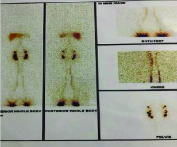 Immunological Examination