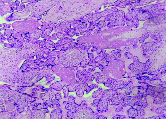 Placenta Histology