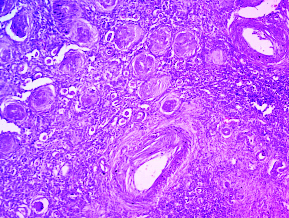 Histopathological diagnosis of non-neoplastic lesions.