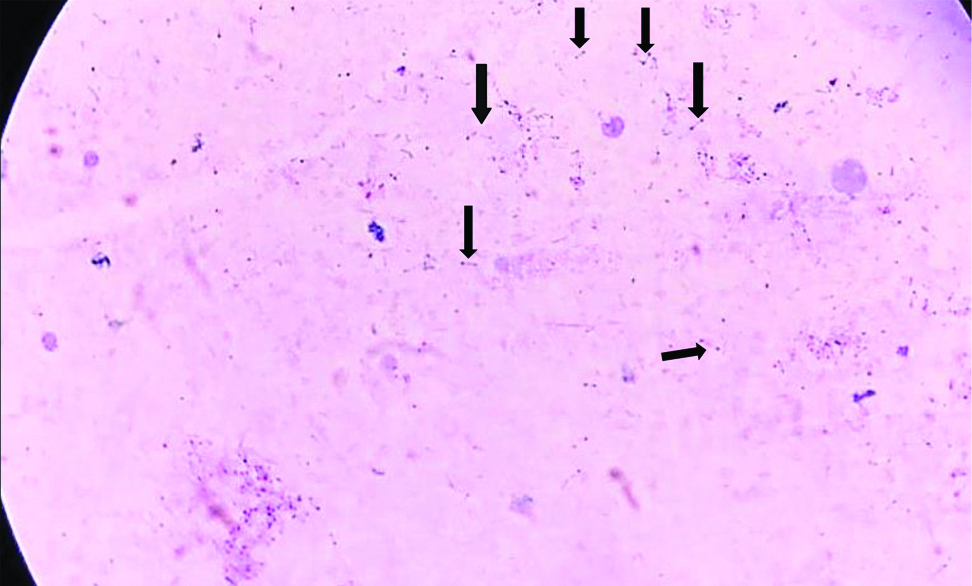Corynebacterium Diphtheriae Albert Stain