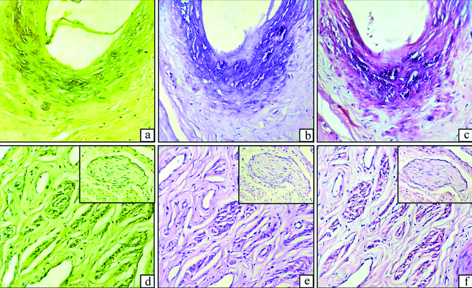 Ectocervical Squamous Epithelium