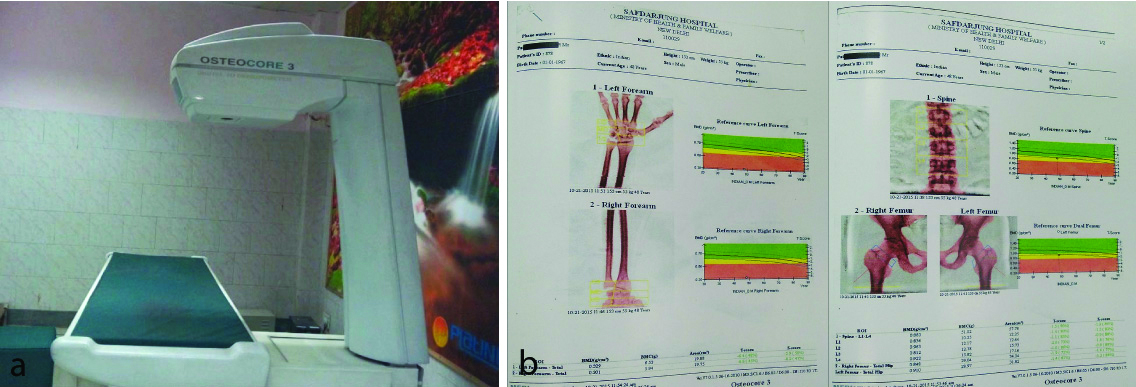 a) DEXA machine used in present study. b) DEXA report sample. DEXA ...