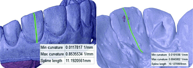 The labial and palatal surface of canine.