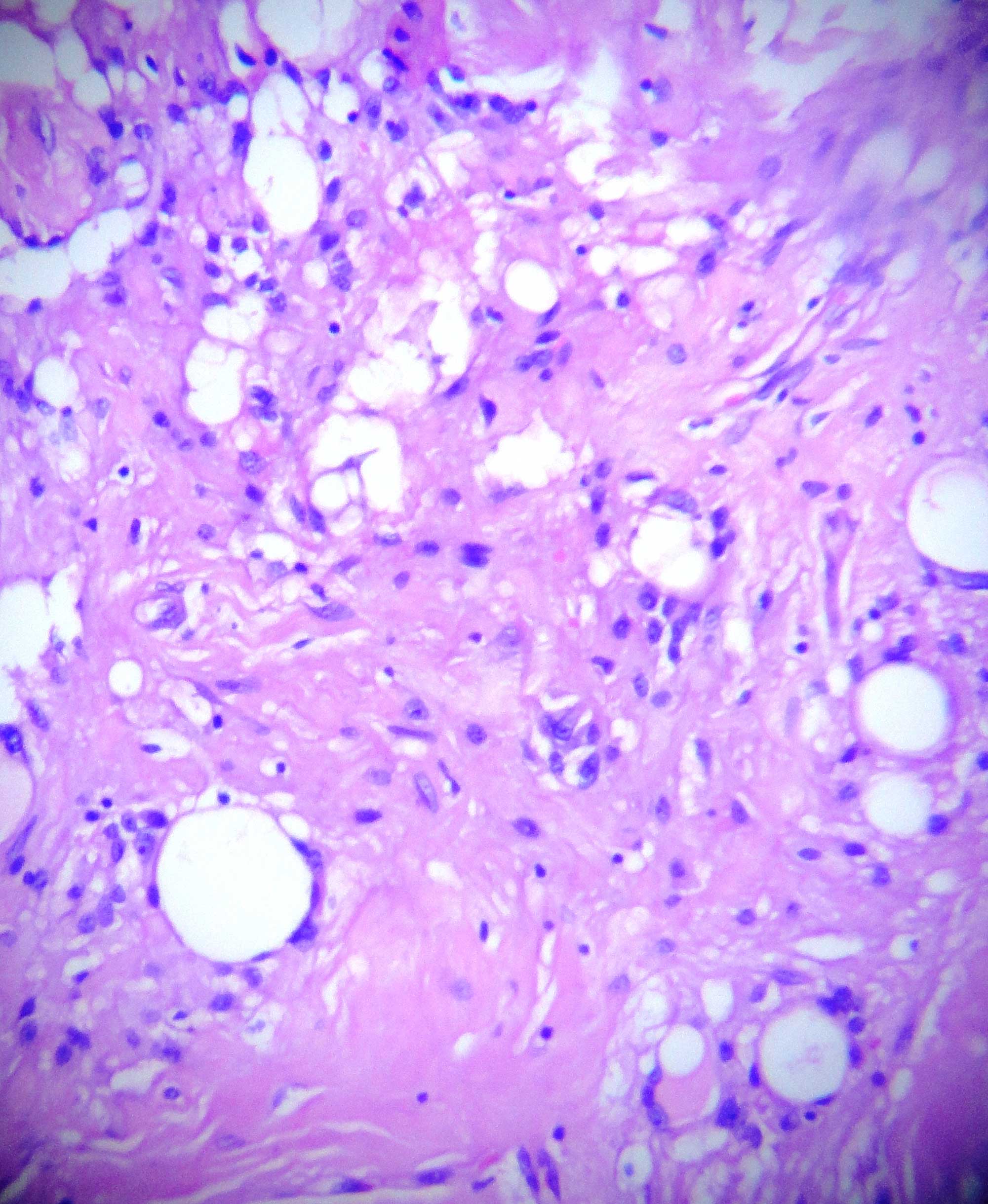 Immuno histo chemistry: