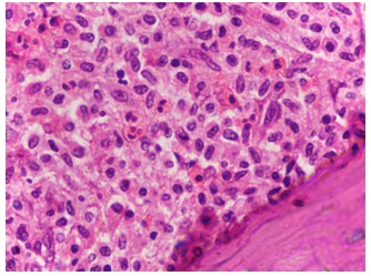 Mast Cell Histology