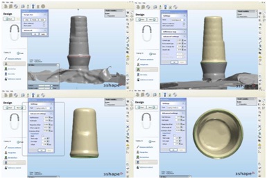 Printed resin coping on die