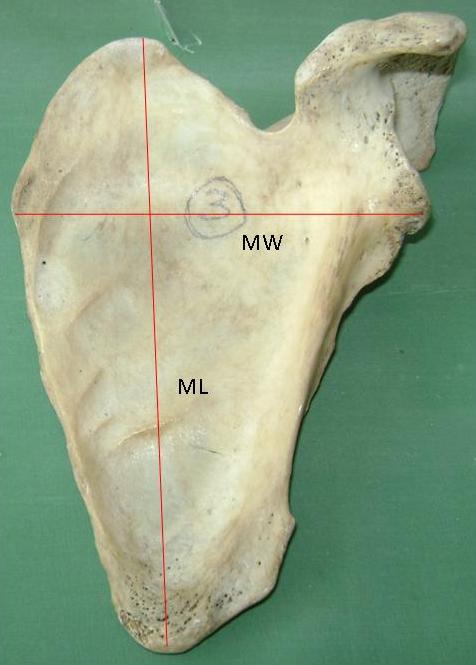 Morphological width (MW): Maximum width of the scapula [ Table/Fig-1 ].