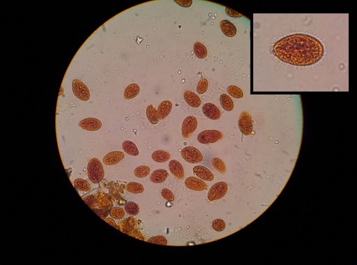 Balantidium Coli Slide