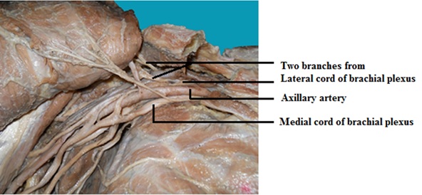 Pectoralis Minor Cadaver