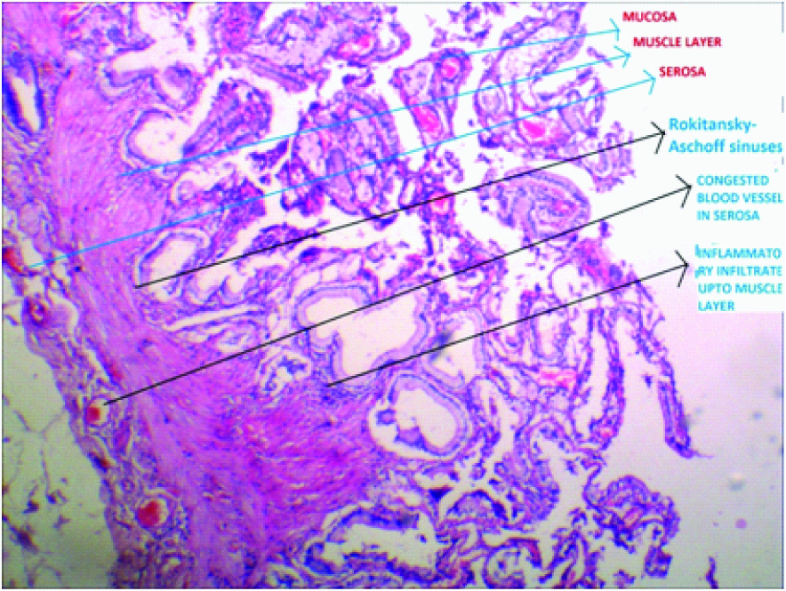 Gallbladder Histology Layers