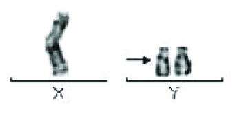 Mosaic karyotype showing mos 45,X[45]/46,XY [ 5 ]