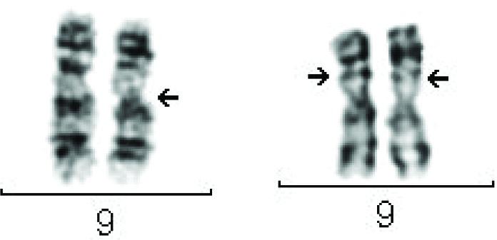 Autosomal polymorphism