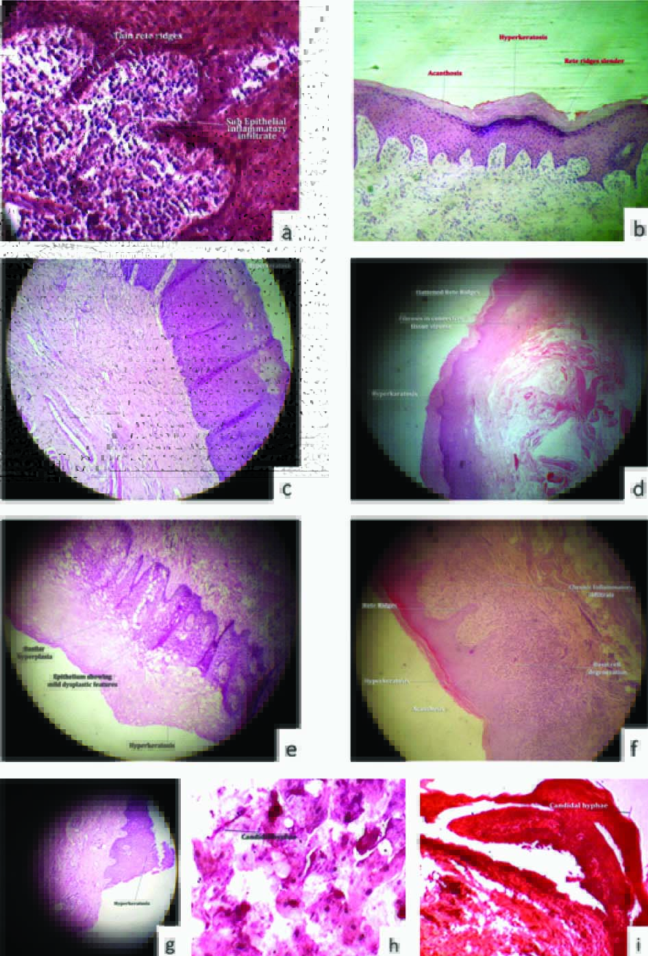 [ Table/Fig-2a–i ] correspond to the histopathological pictures of ...