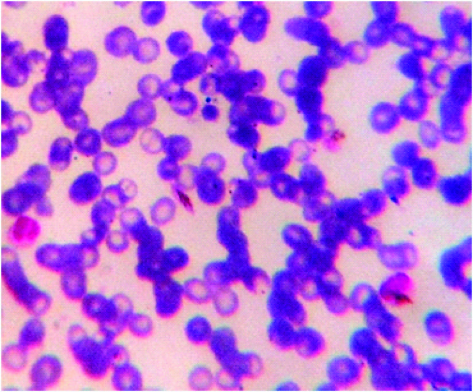 Field stain, 10x field, MIPS